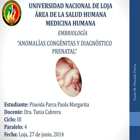 Anomalías congénitas y diagnóstico prenatal | PPTX