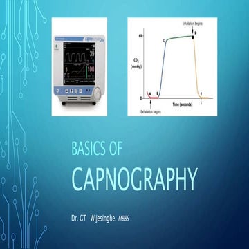 Basics of Capnography | PPTX