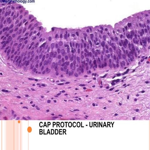 Cap protocol bladder | PPTX