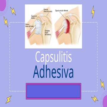 CAPSULITIS ADHESIVA O SÍNDROME DE HOMBRO CONGELADO.pptx