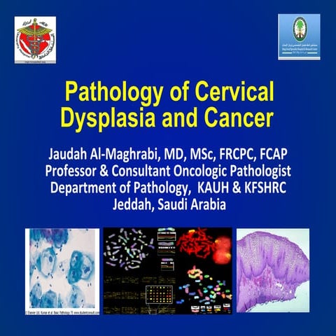 Carcinoma of cervix pathology | PDF