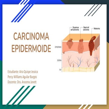 CARCINOMA EPIDERMOIDE Dermatología Clínica | PPTX