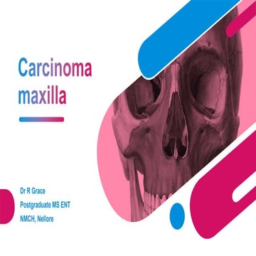 Carcinoma maxilla.pptx