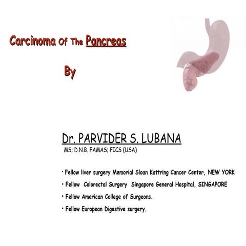 Carcinoma Pancreas Dr PS Lubana | PPT