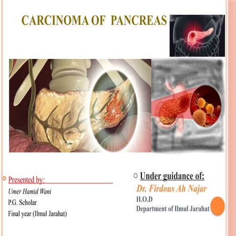 carcinoma pancreas 2.pptx pancreatic cancer incidence and treatment ...