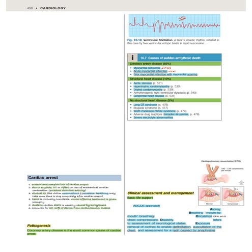 Cardiac arrest (cardiovascular system).pdf