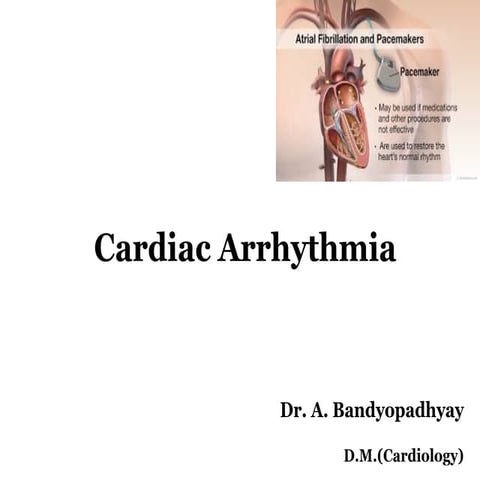 Cardiac arrhythmias | PPT