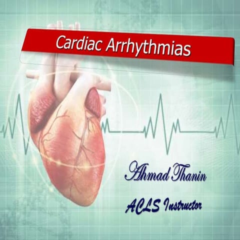 Cardiac arrhythmia | PPTX