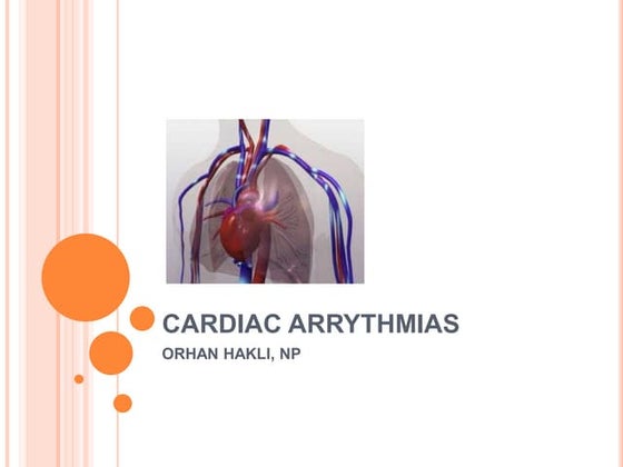 Arrythmia | PPTX