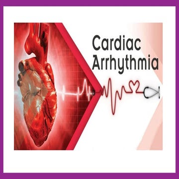 cardiac arrythmias .my presentation (1) - Copy.pptx