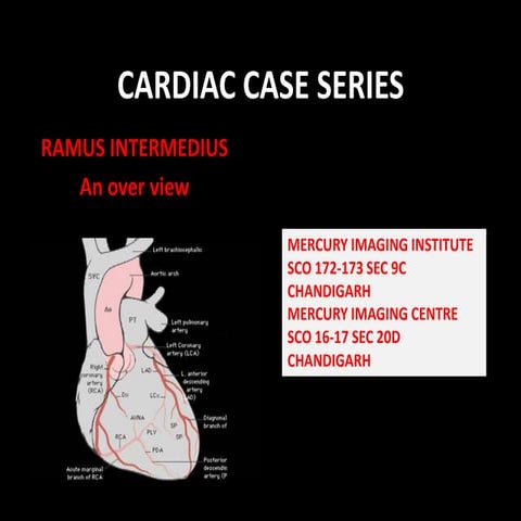 Cardiac case series ramus intermedius | PPTX
