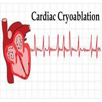 Cardiac Cryoablation.pptx