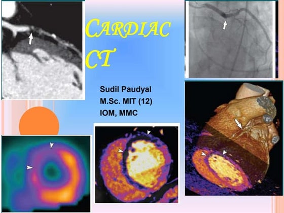 Ct pulmonary angiogram (ctpa) | PPT
