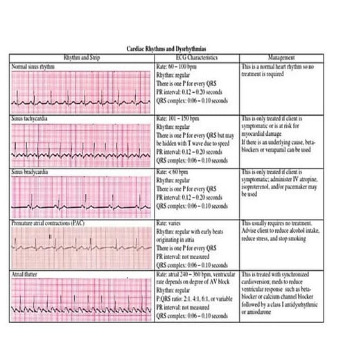 Cardiac dysrhythmias.pdf