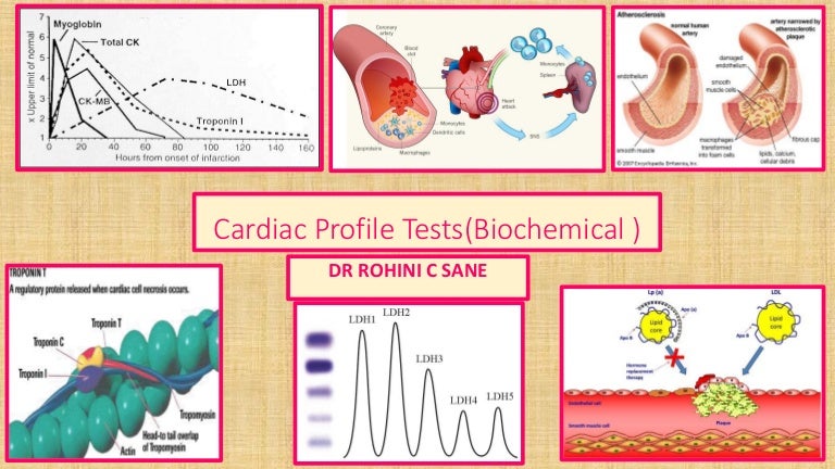 Cardiac profile tests(biochemical )