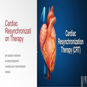 Cardiac Resynchronization Therapy Pptx