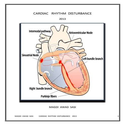 Cardiac rhythm disturbance | DOCX