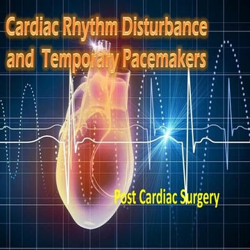 Cardiac Rhythm Disturbance and Temporary Pacemakers.pdf