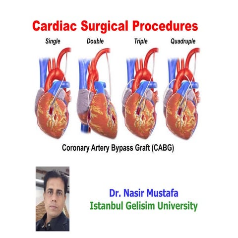 Cardiac surgical procedures | PPT