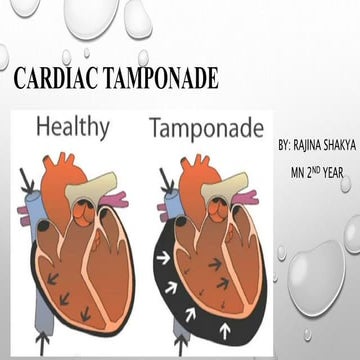 Cardiac tamponade