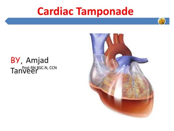 Cardiactamponade 140904122431-phpapp02 | PPT