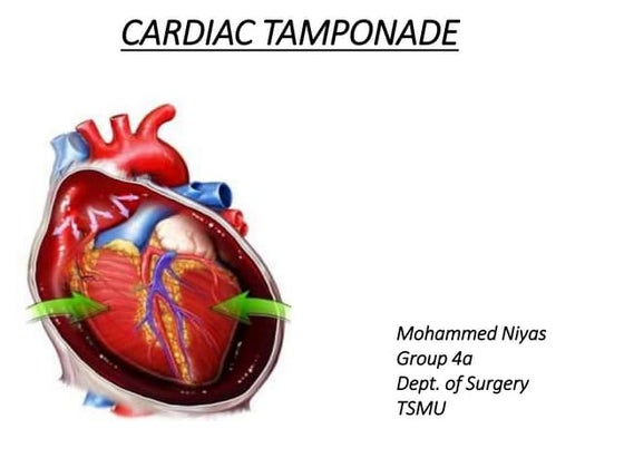 Cardiac tamponade | PPTX | Heart and Cardiovascular Diseases | Diseases ...