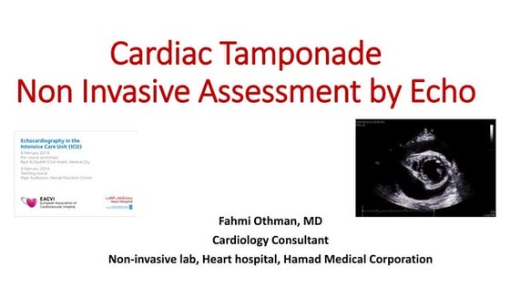 ECHOCARDIOGRAPHY IN CARDIAC TAMPONADE | PPTX