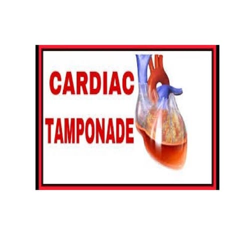 Cardiac Tamponade Pptx Pptx