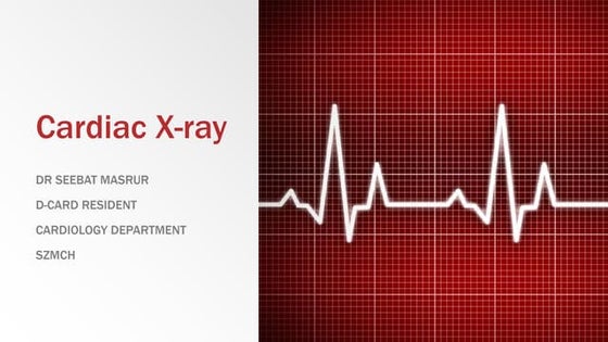 Cardiophrenic angle | PPTX | Heart and Cardiovascular Diseases ...
