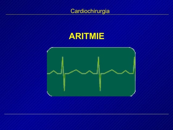 Cardiochirurgia Aorta Toracica | PPT