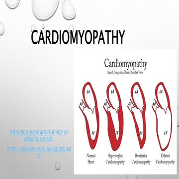 Cardiomyopathy | PPT