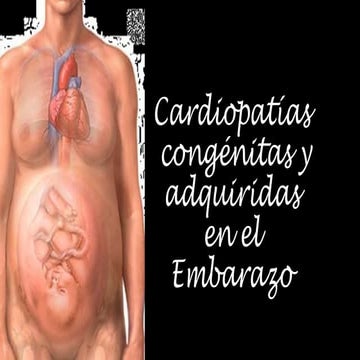 Cardiopatías En El Embarazo Congenitas Y Adquiridas Ppt
