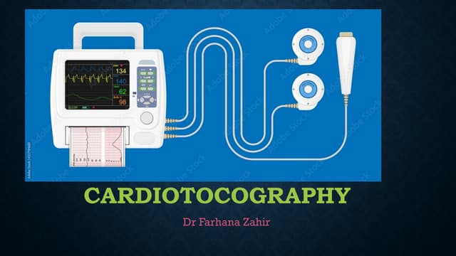 Cardiotocography | PPTX
