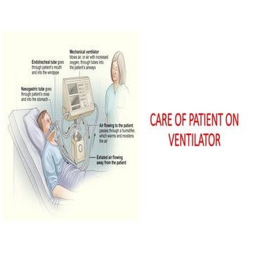 Nursing Care of Ventilated Patient | PPTX