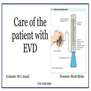 External Ventricular Drain (EVD) | PPTX