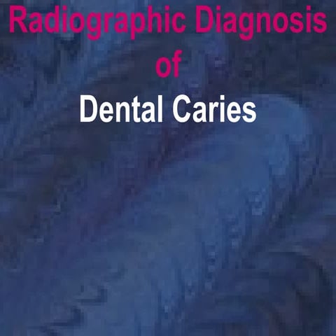 IOPA INTERPRETATION.ppt