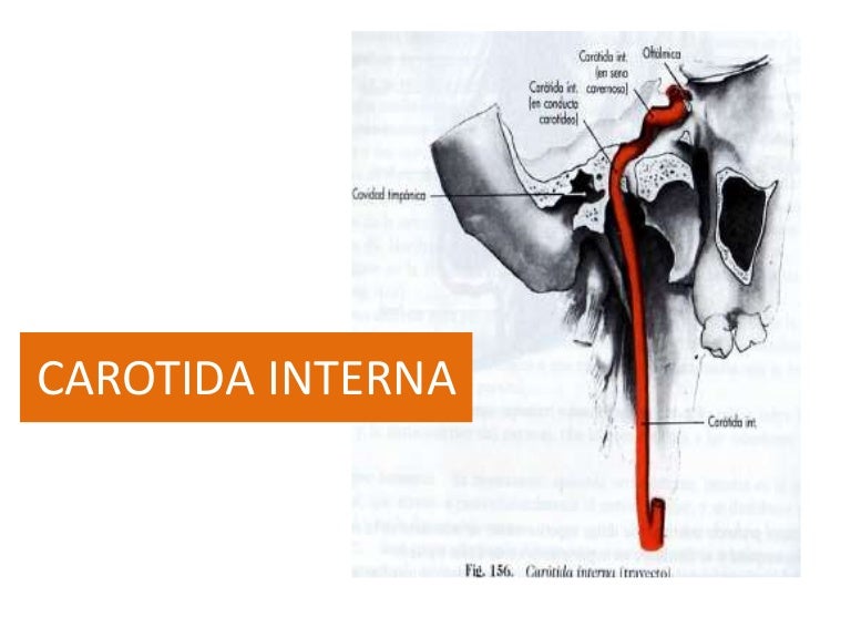 Carotida interna