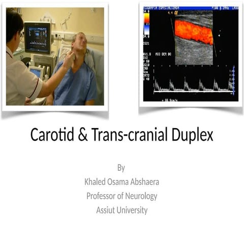 Carotid and transcranial duplex complete examination | PPTX