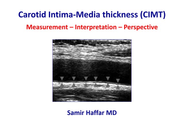 Carotid Intima Media Thickness Ppt