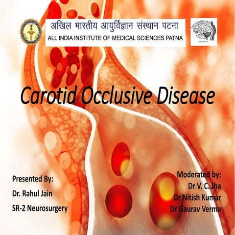 Carotid Occlusive Disease.pptx