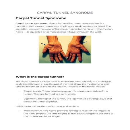 Carpal tunnel syndrome | PPT