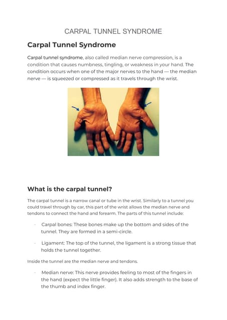 Carpal tunnel Syndrome | PDF