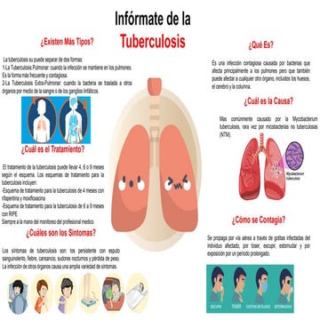 Cartelera basica y ligera sobre la Tuberculosis | PDF