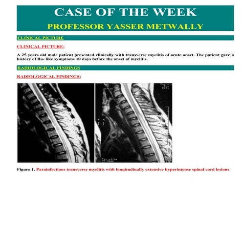 Case record...Acute postinfectious transverse myelitis (Transverse ...