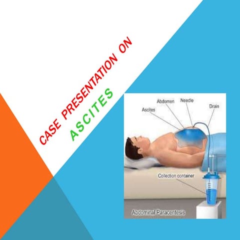 Ascites for medicine residents and doctors | PPT