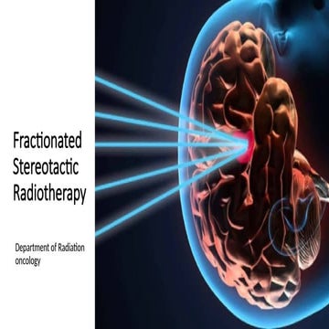 FSRT Fractionated Radiotherapy in Schwannoma | PPTX | Cancer | Diseases and Conditions