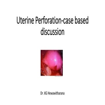 Case discussion uterine perforation | PPT