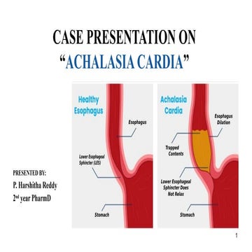 Case on ACHALASIA CARDIA / PharmD / Case Presentation / ppt | PPTX