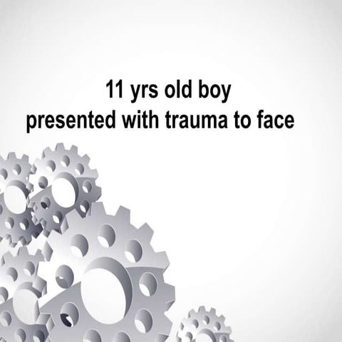 Avulsion | PPT