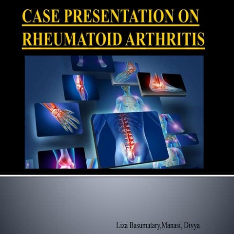 RHEUMATOID ARTHRITIS. | PPT